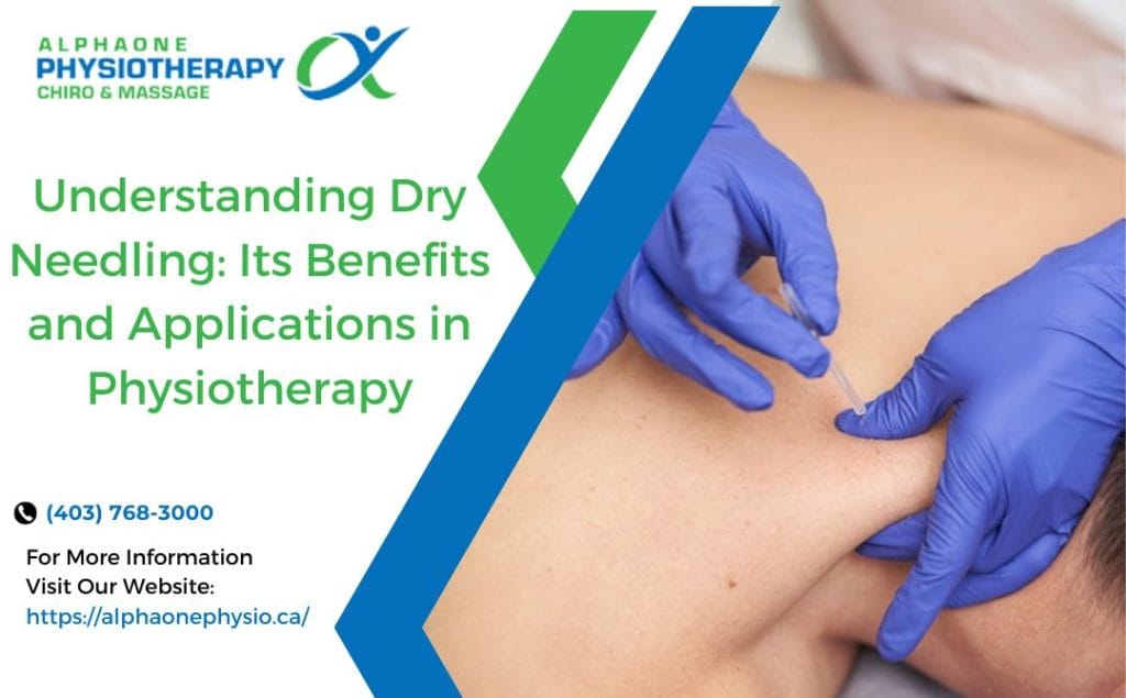 Dry Needling: Benefits, Process & Pain Relief Solutions